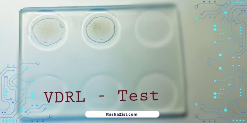 آزمایش VDRL چیست؟ اصول، مراحل و تفسیر نتایج! 💎
